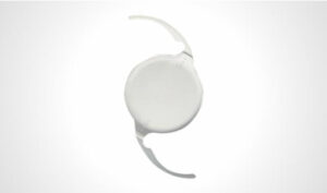 Cataract Surgery: What You Need to Know